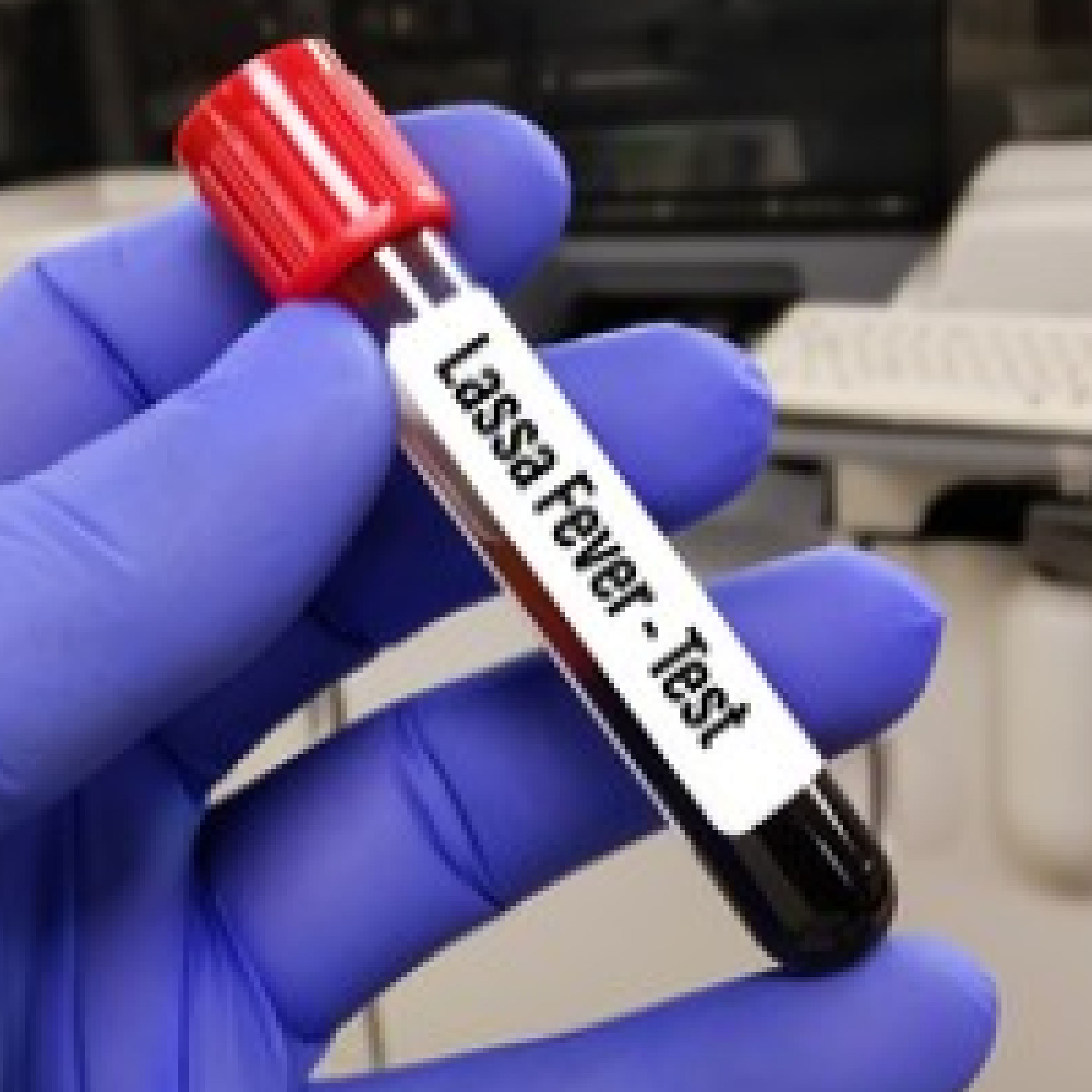 Fiebre de Lassa | frequenz-therapie.com