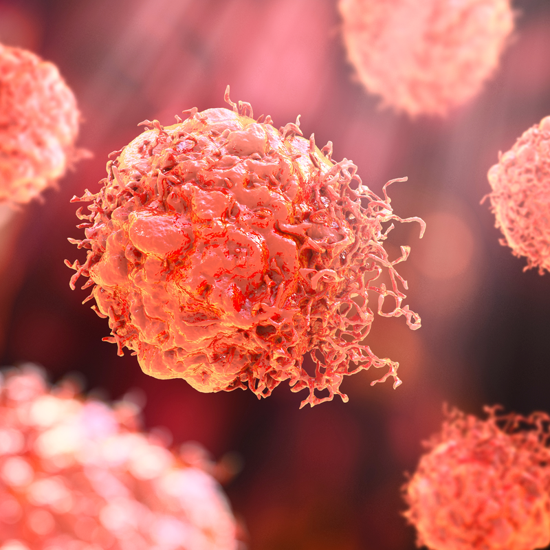 Sarcoma epitelioide mixoide | frequenz-therapie.com