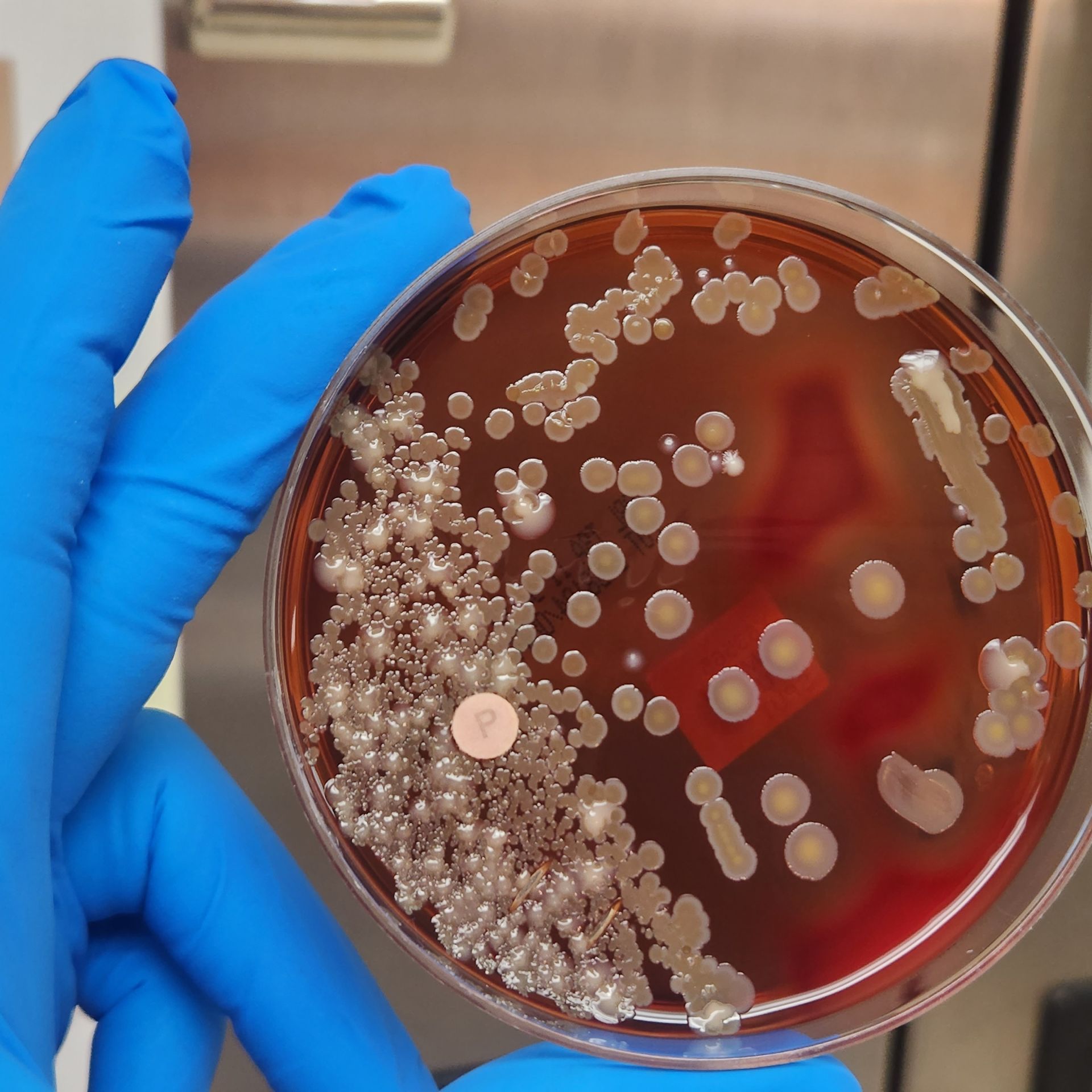 La bacteria Acinetobacter y su importancia para la salud | frequenz ...