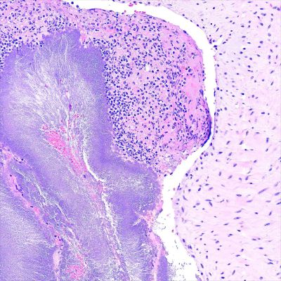 Actinobacillus equuli | frequenz-therapie.com