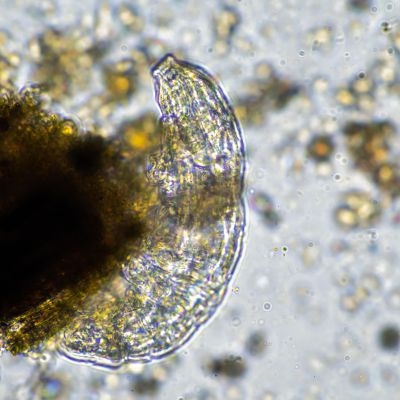 Bacteroides fragilis | frequenz-therapie.com