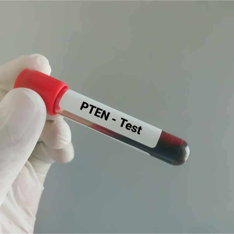 Syndrome de Bannayan-Riley-Ruvalcaba | frequenz-therapie.com